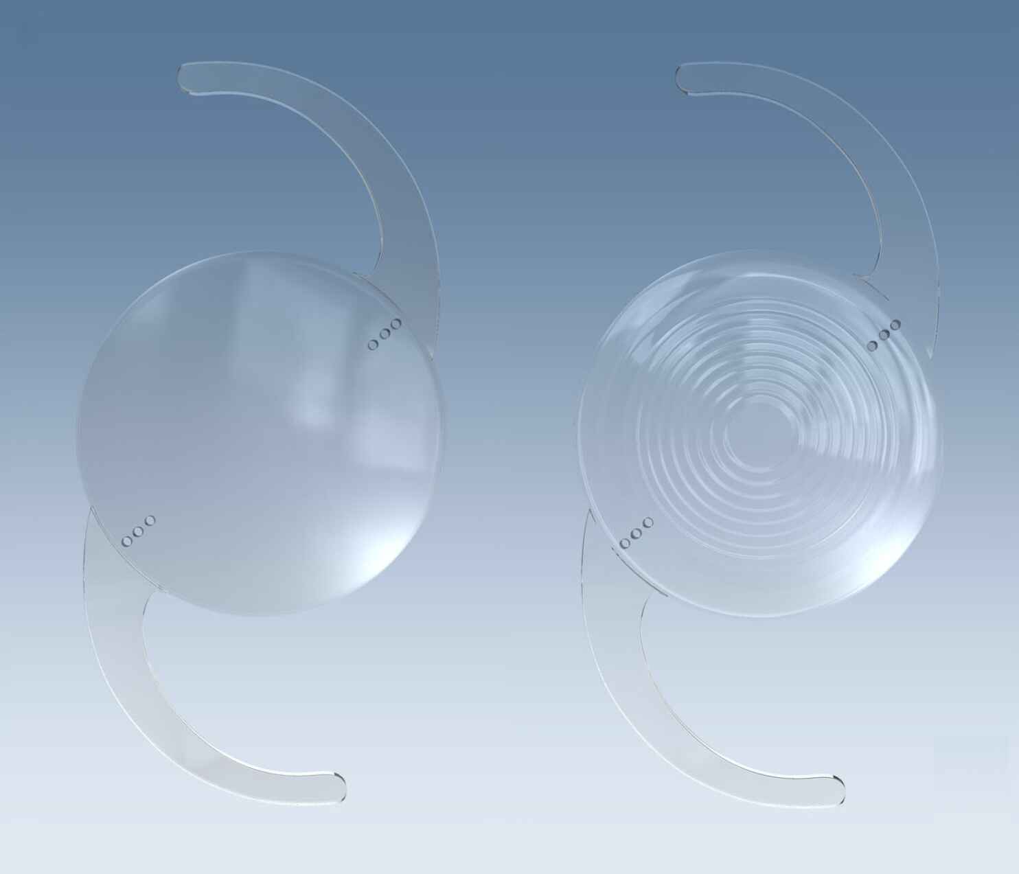 Clear Lens Exchange (CLE) - Vision Correction at Kagan Institute